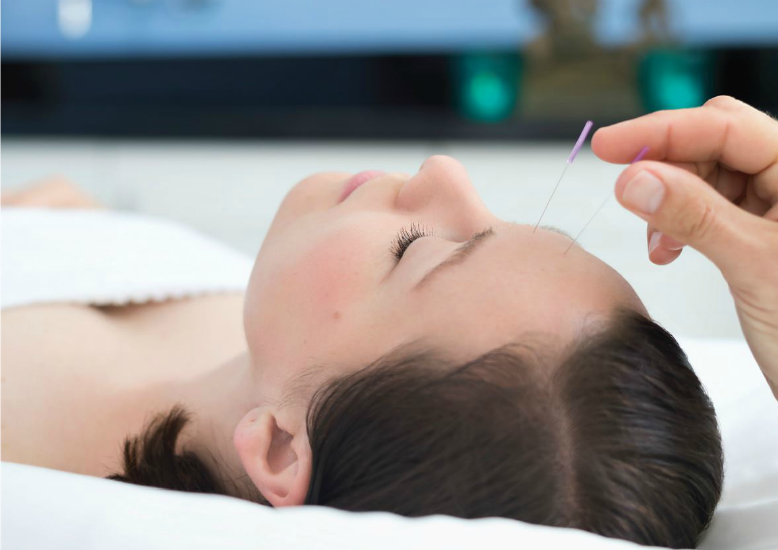welcome spring with an acupuncture seasonal tune up | London